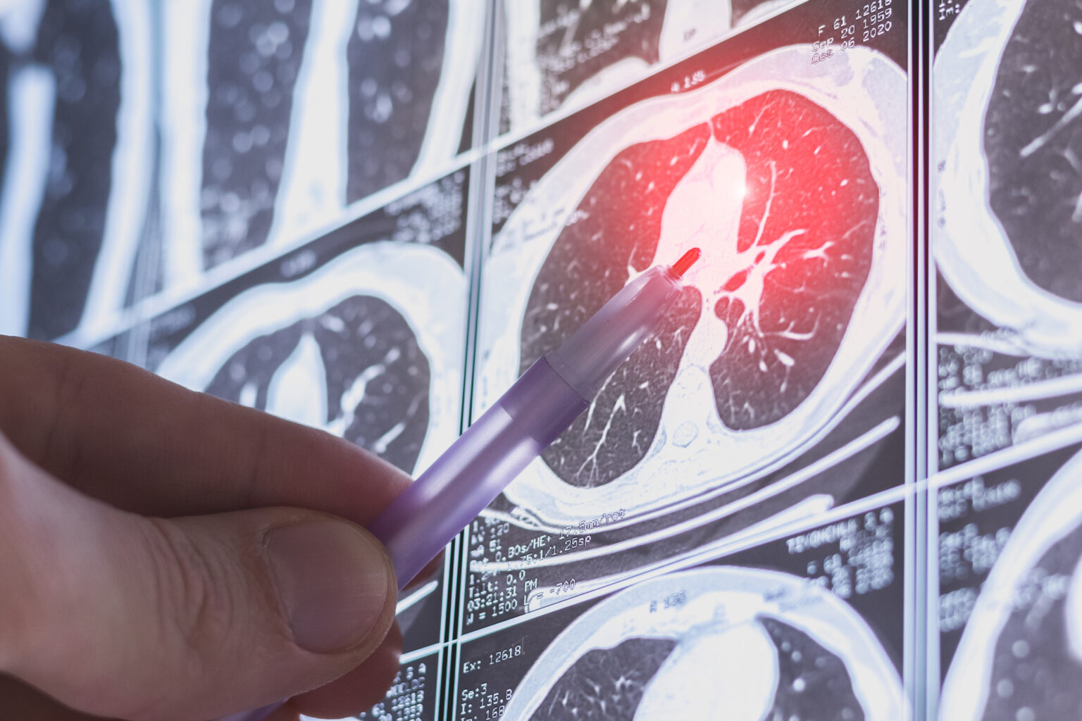 What to Expect from a Cardiac CT Scan | Sussex Premier Health